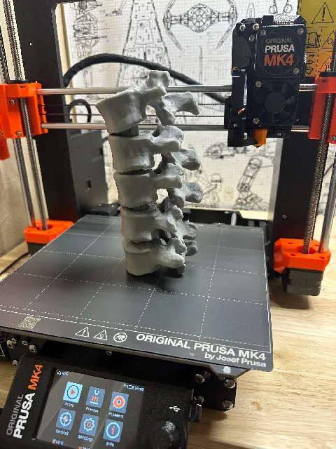 Make of Spine Model from CT Scan / Printable Medical Model by ...