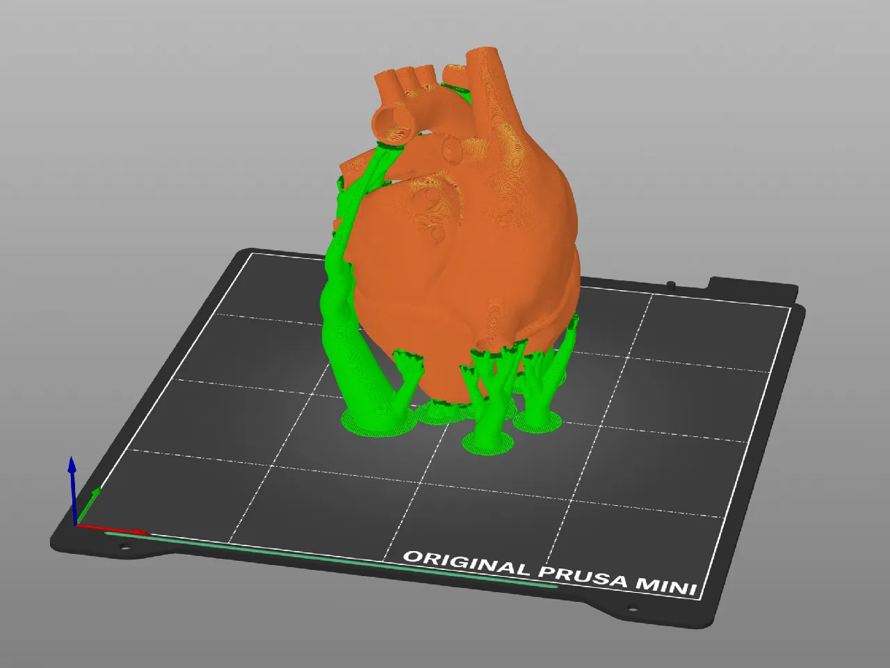 Anatomical Heart (Solid Body) by astrophage | Download free STL model ...