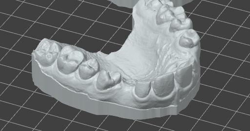 teeth by Levy Guttman | Download free STL model | Printables.com