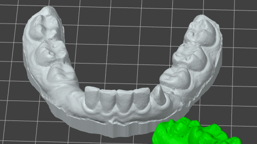teeth by Levy Guttman | Download free STL model | Printables.com