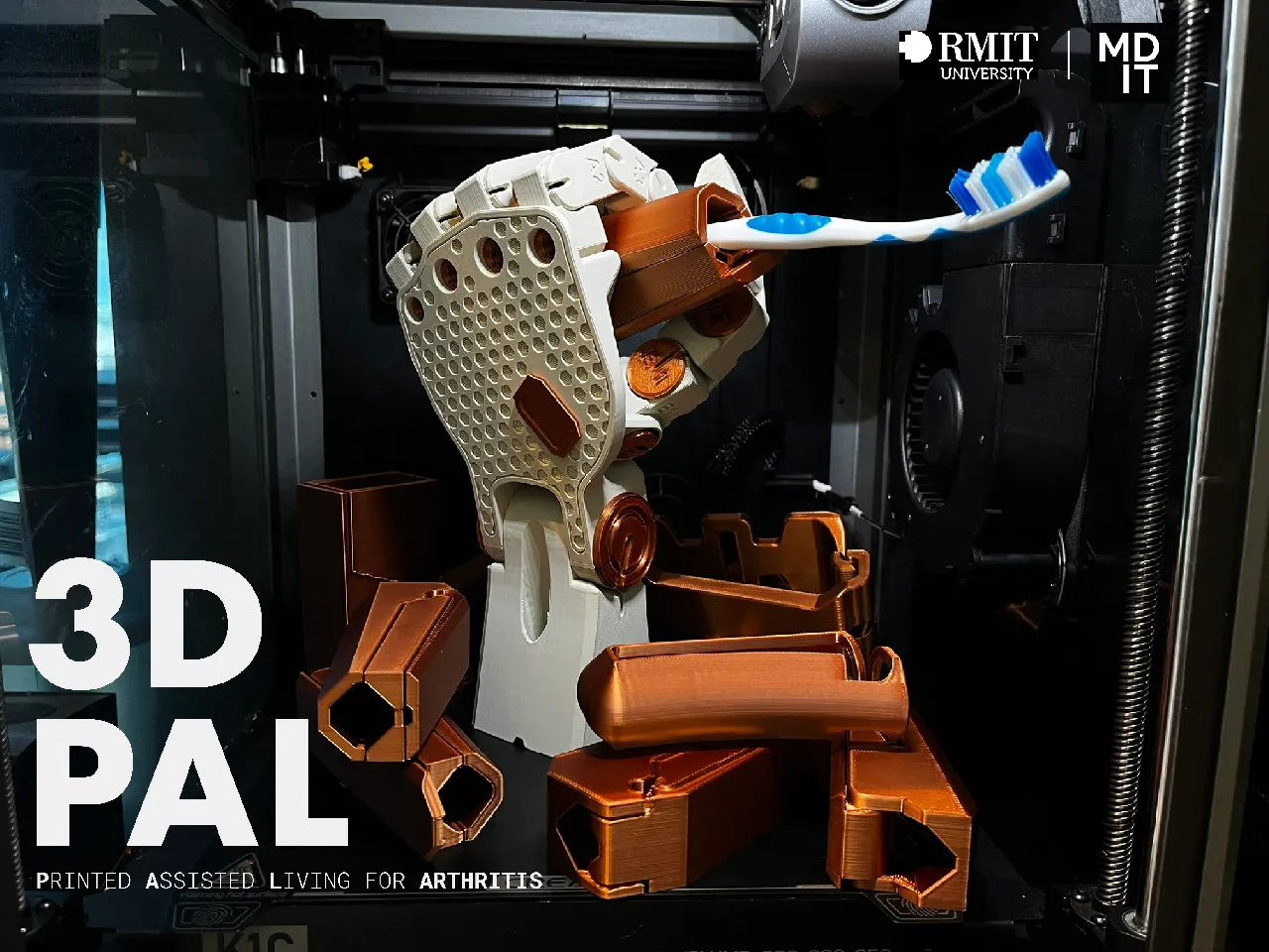 3DPAL: Assistive Devices for Arthritis by Marshall | Download free STL ...