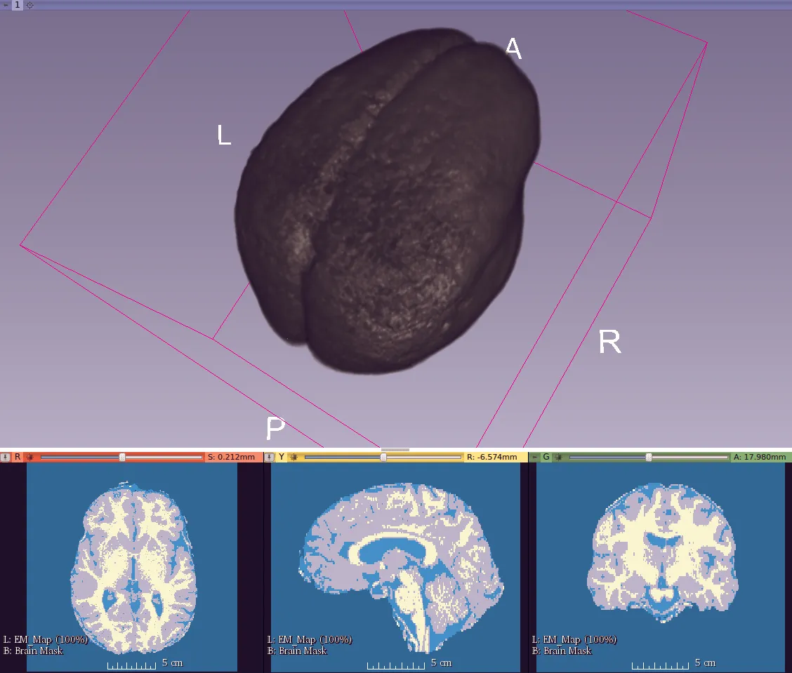 Certified Insane Person's Brain, ---Mine. by flyCouch | Download free ...