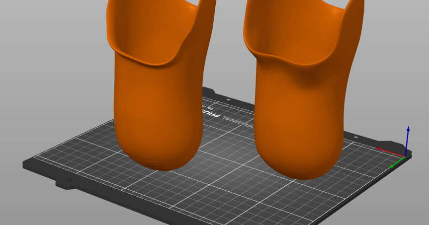 Transtibial (below-knee) prosthetic (single-walled) sockets by mbastas ...