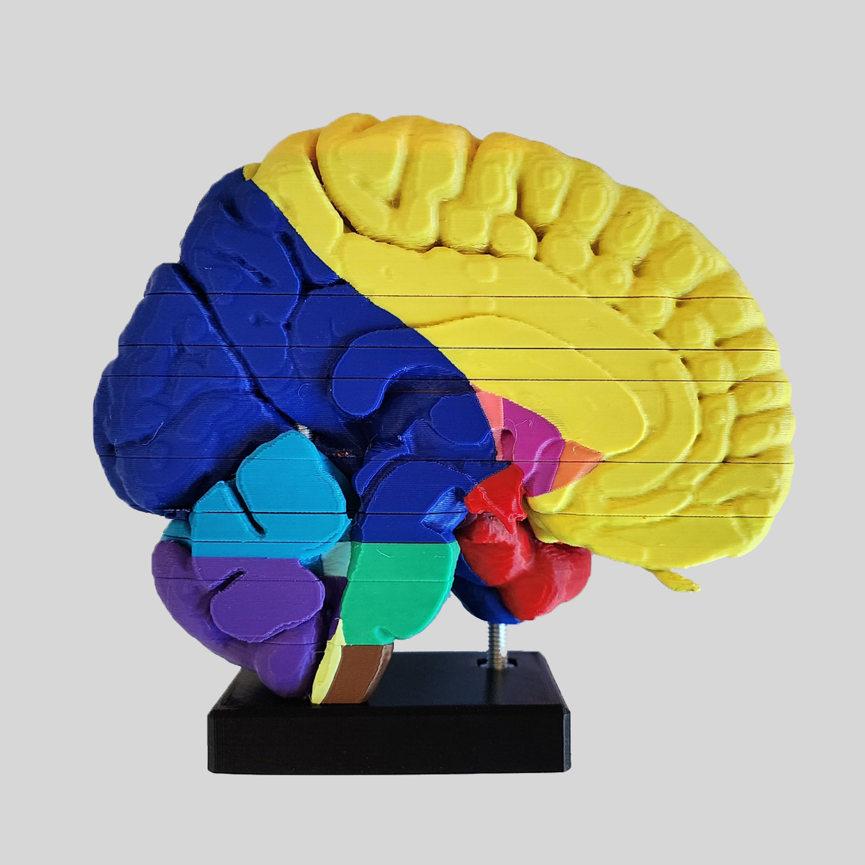 Cerebral Vascular Territories Model by DanMan | Download free STL model ...