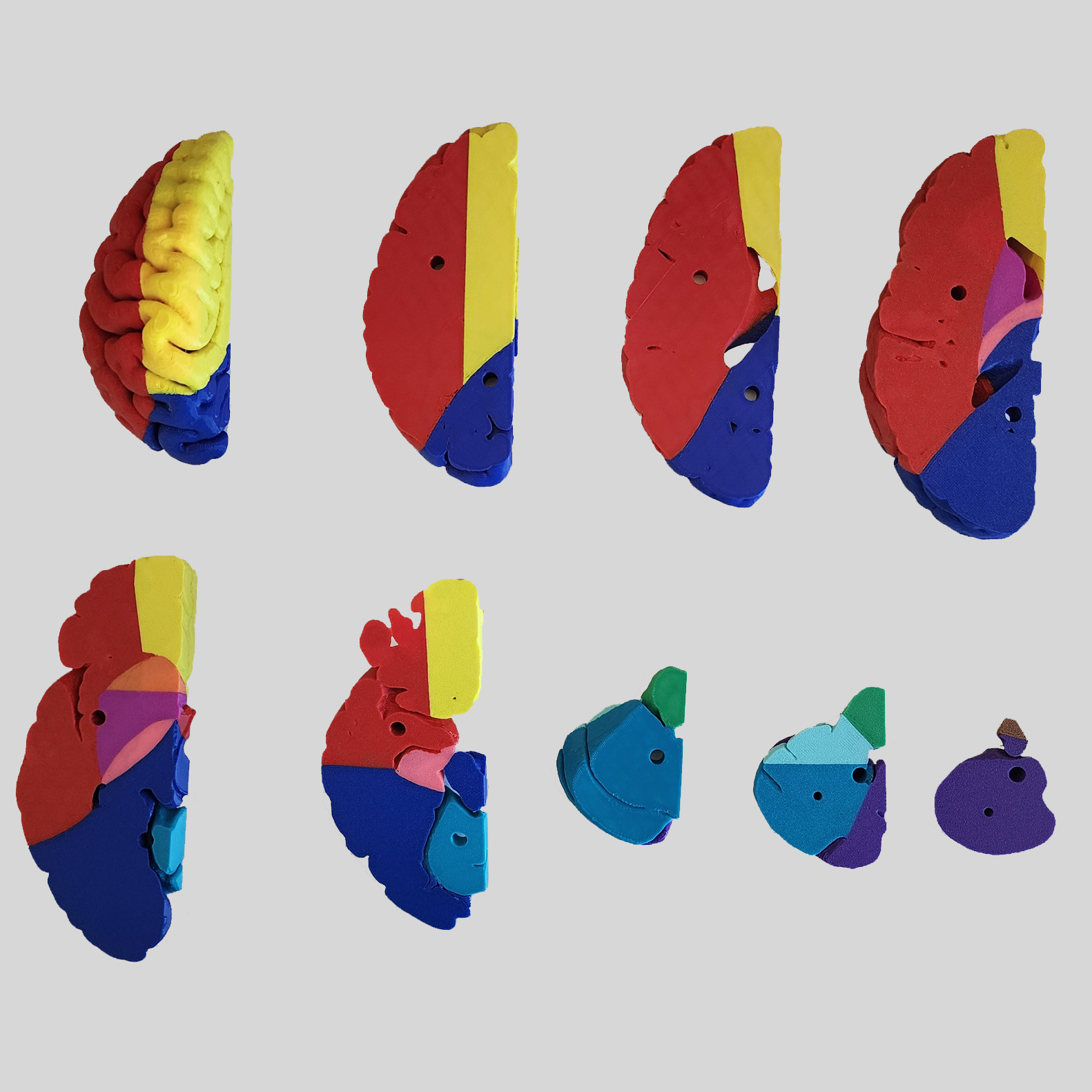 Cerebral Vascular Territories Model by DanMan | Download free STL model ...