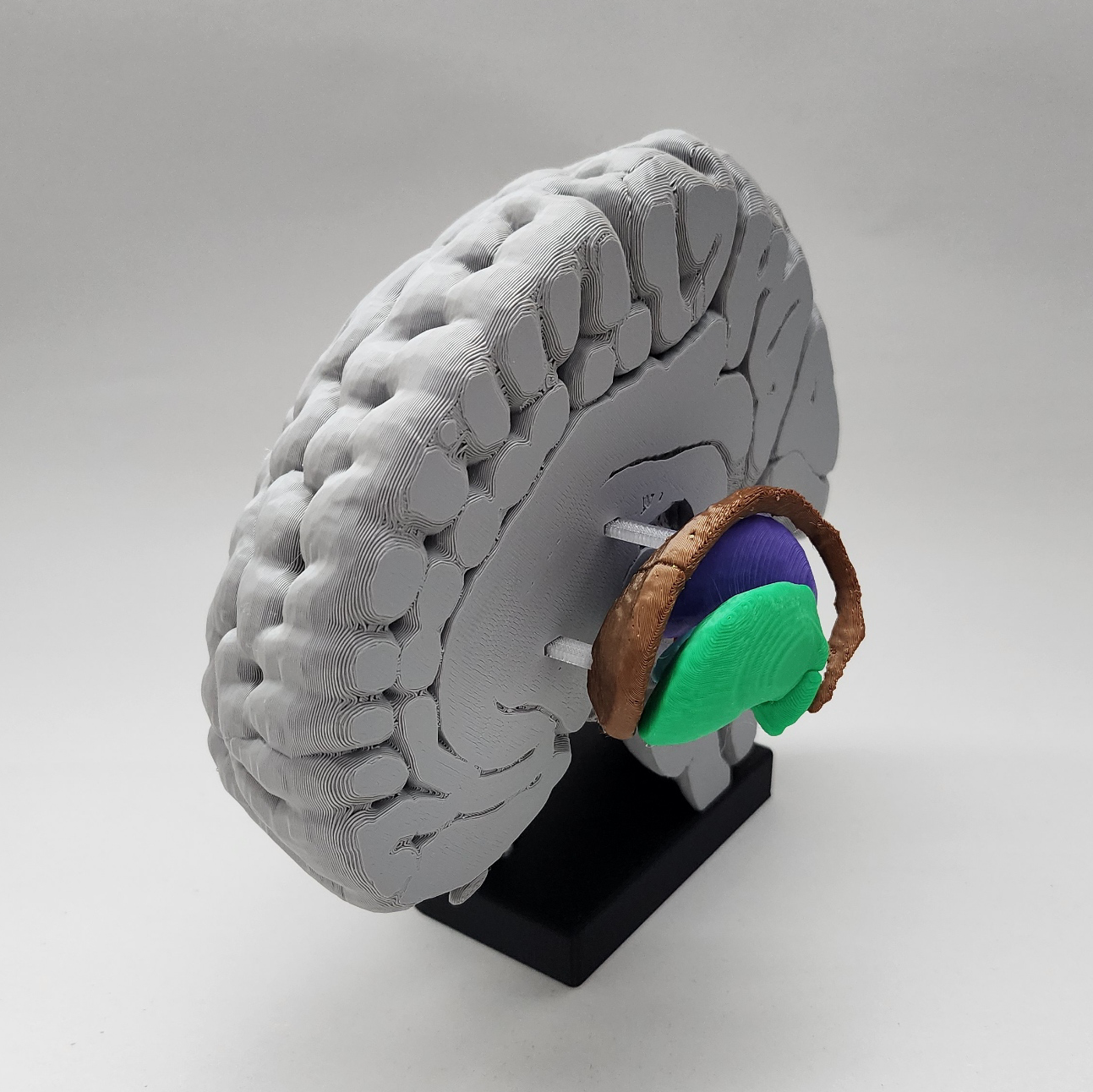 Basal Ganglia (Deep Brain Nuclei) by DanMan | Download free STL model ...