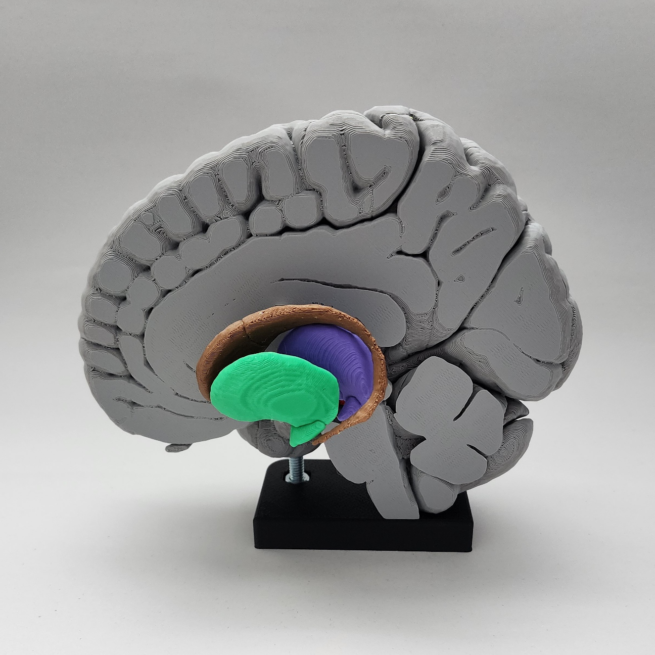 Basal Ganglia (Deep Brain Nuclei) by DanMan | Download free STL model ...