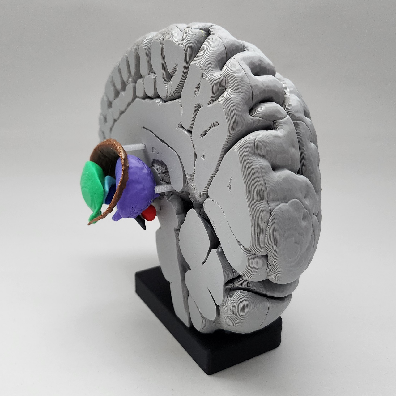 Basal Ganglia (Deep Brain Nuclei) by DanMan | Download free STL model ...