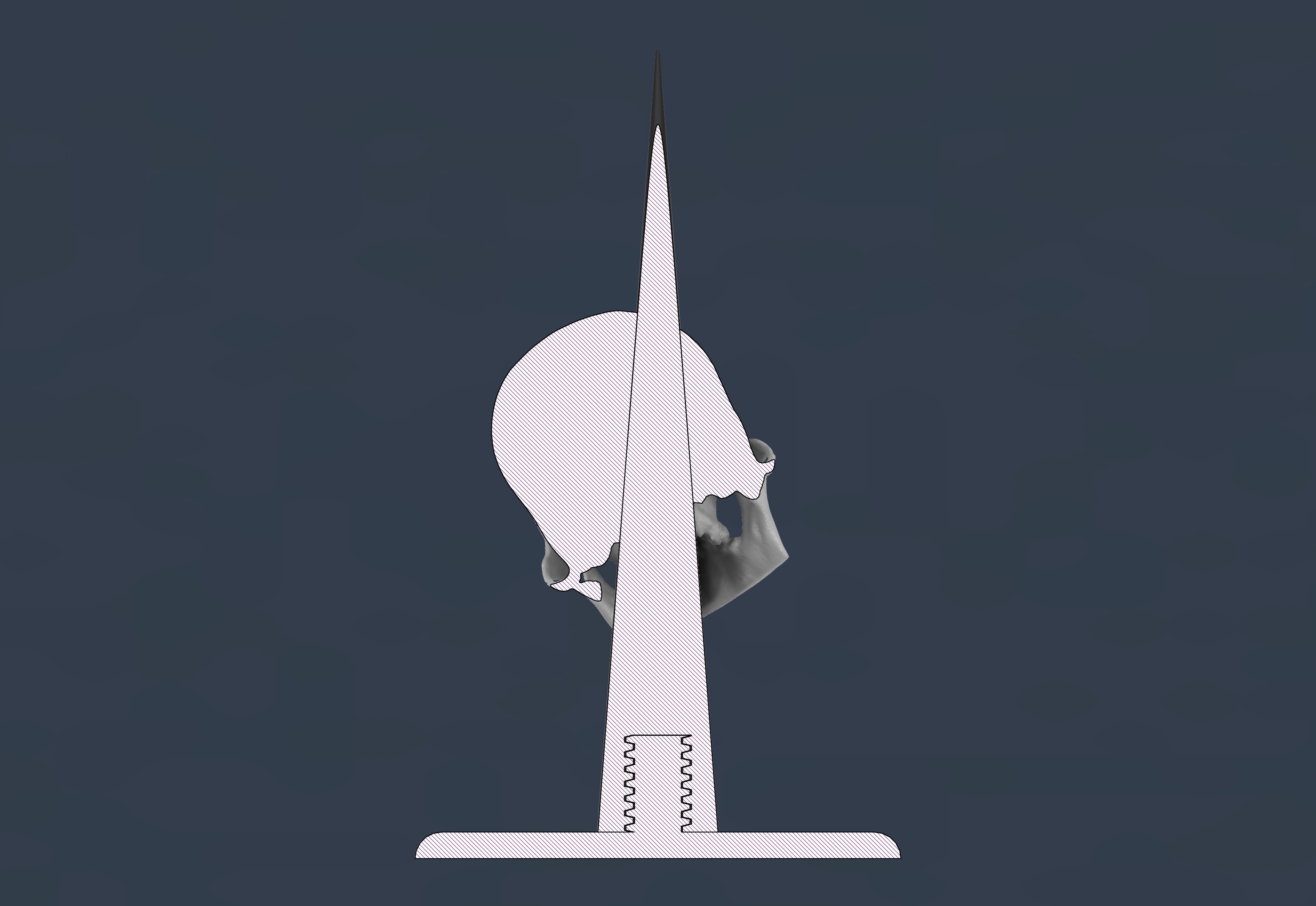 Human Skulls on Spikes (x3) by vidision | Download free STL model ...