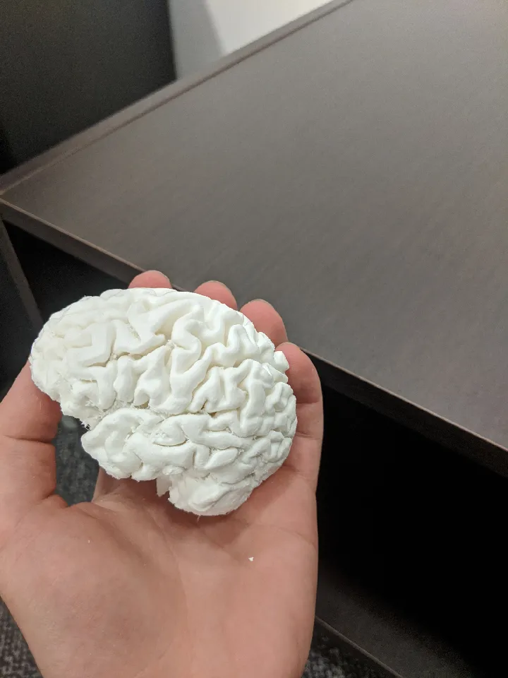 Brain MRI Scan by jassca | Download free STL model | Printables.com