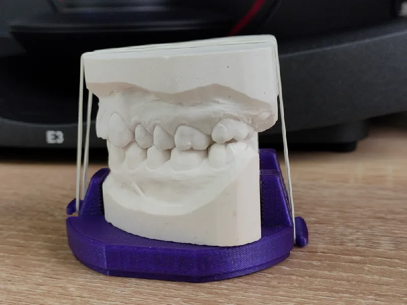 3Shape scanner model holder by Thorin Oakenshield | Download free STL ...