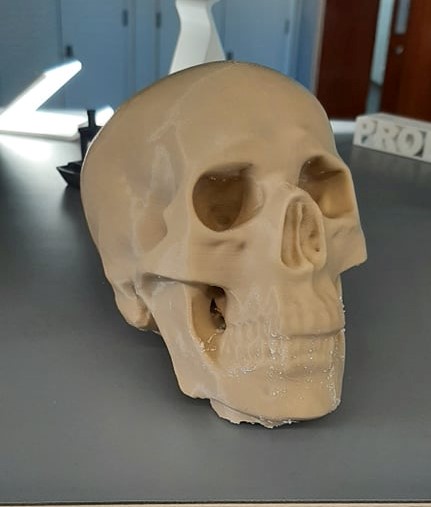 3D scanned Human Skull by Peter H | Download free STL model ...
