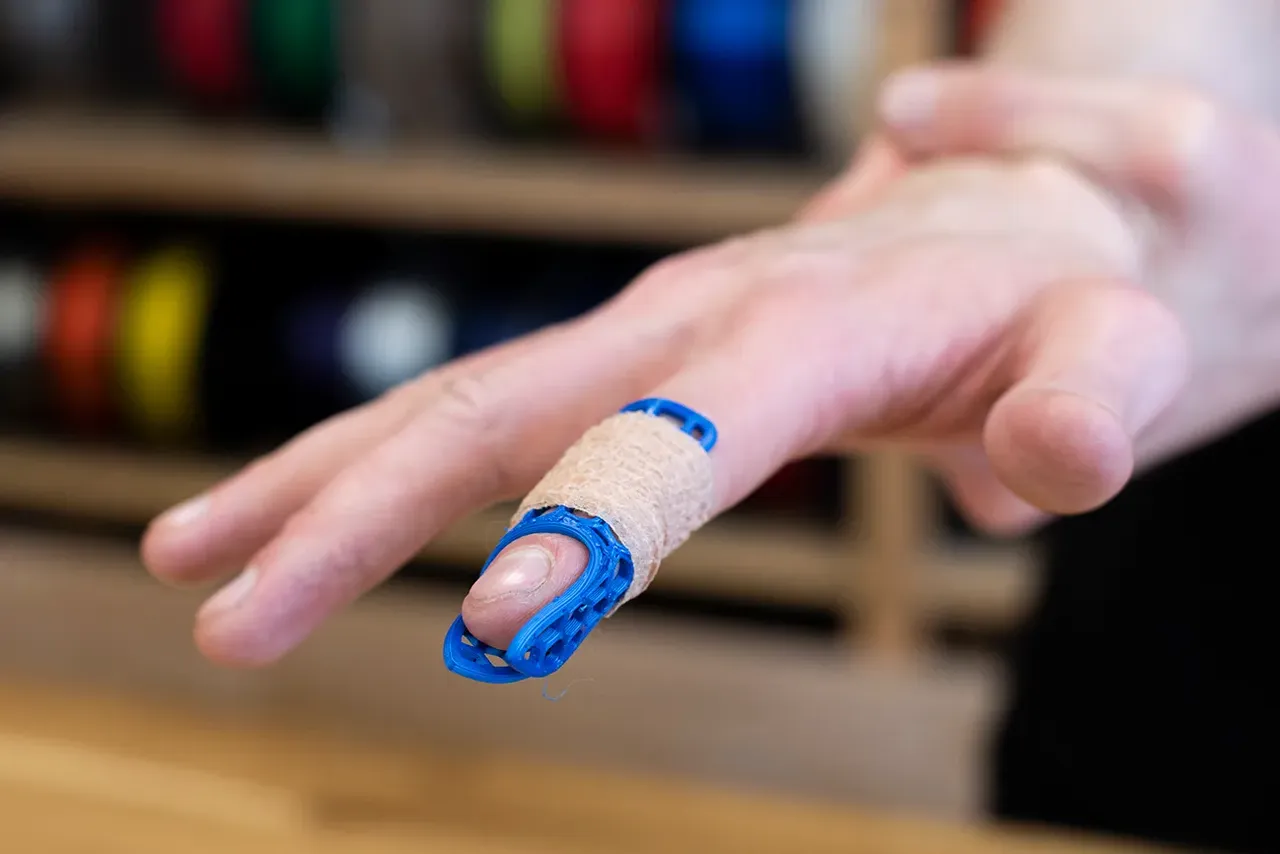 Finger extension brace (splint) by Prusa Research | Download free STL ...