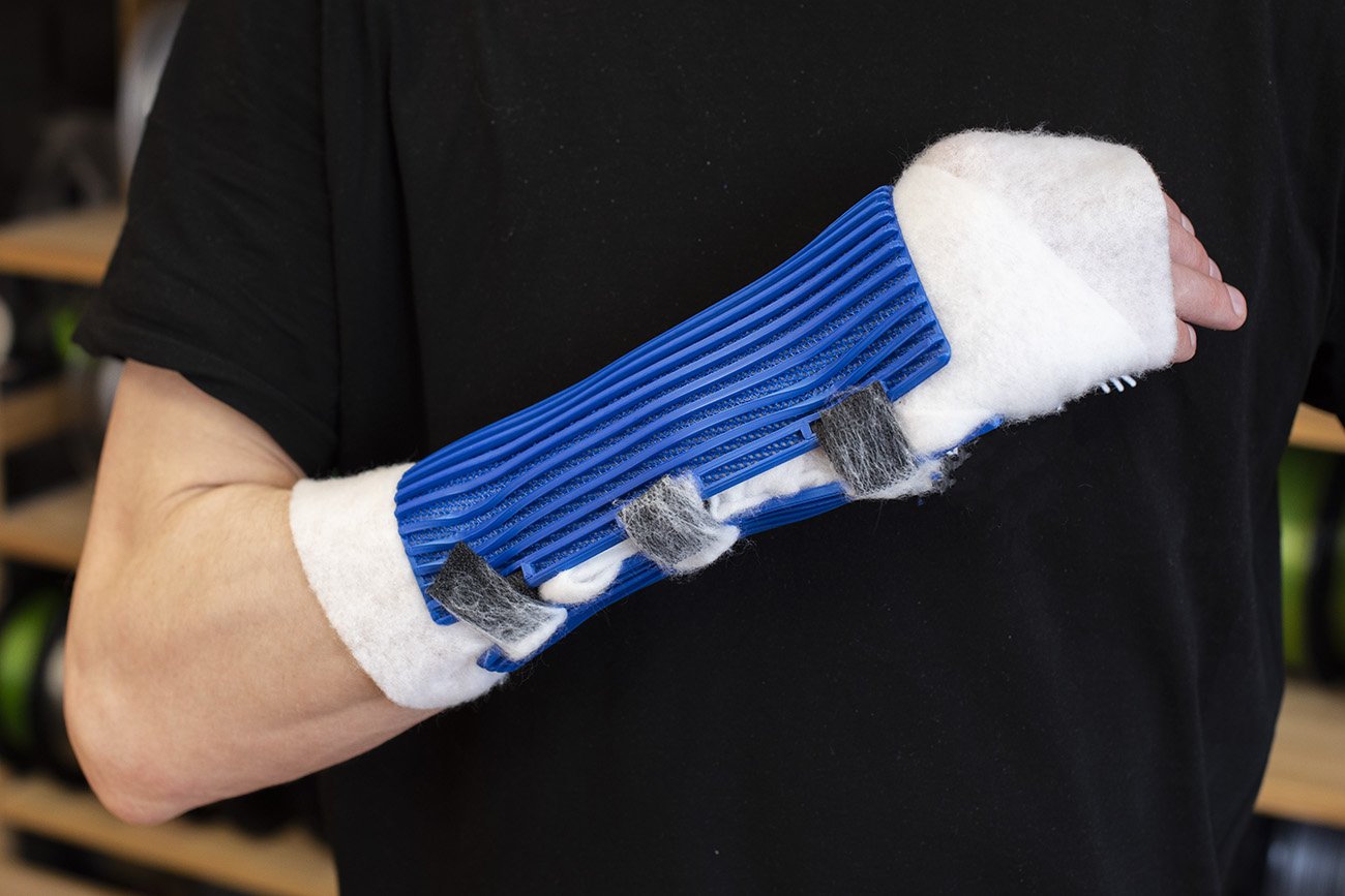 Wrist brace (splint) for either hand by Prusa Research | Download free ...