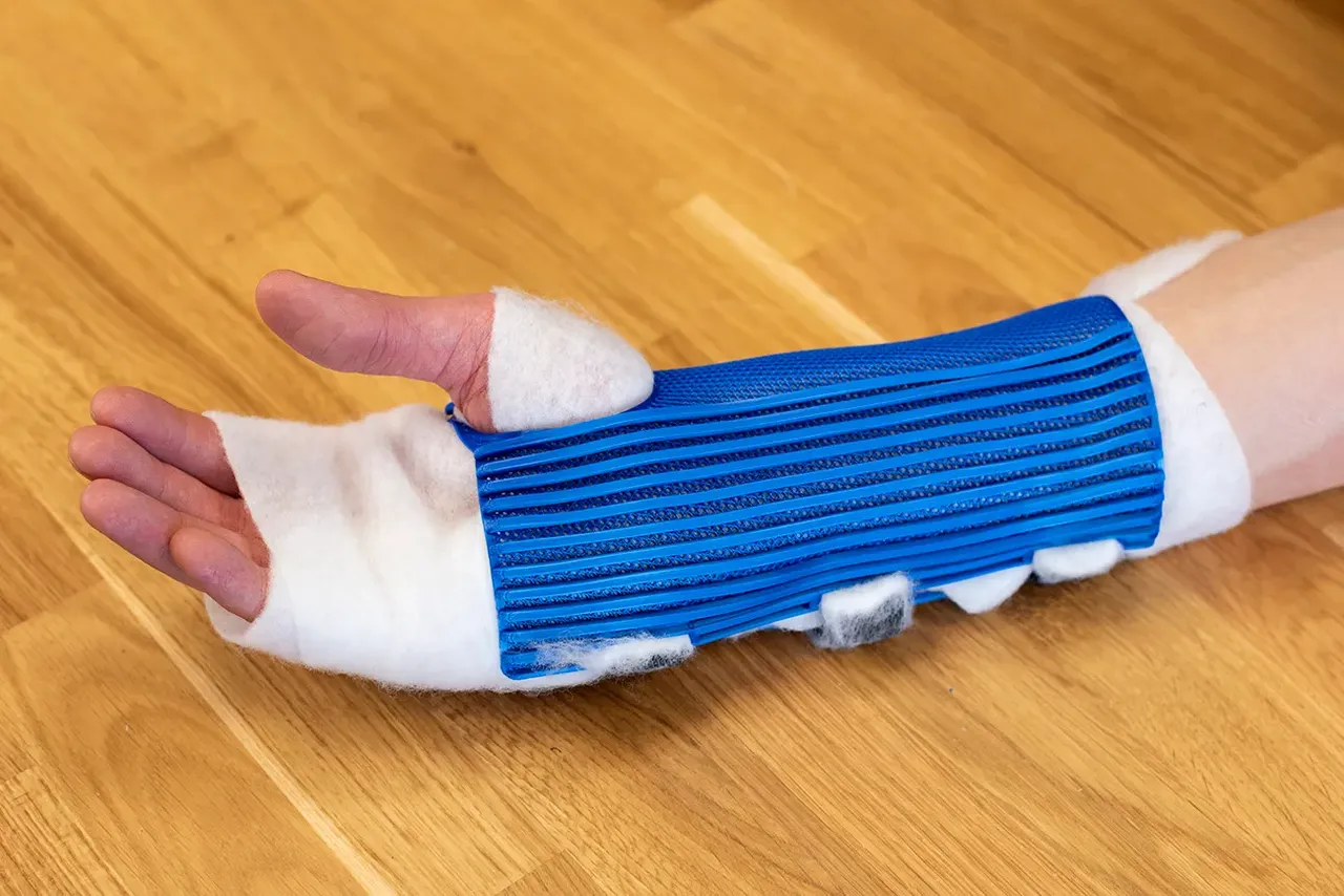 Wrist brace (splint) for either hand by Prusa Research | Download free ...