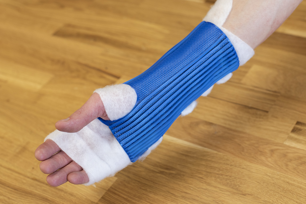 Wrist brace (splint) for either hand by Prusa Research | Download free ...
