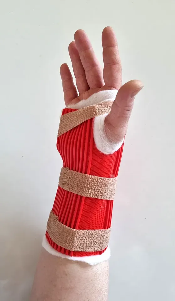 Wrist brace (splint) for either hand by Prusa Research | Download free ...