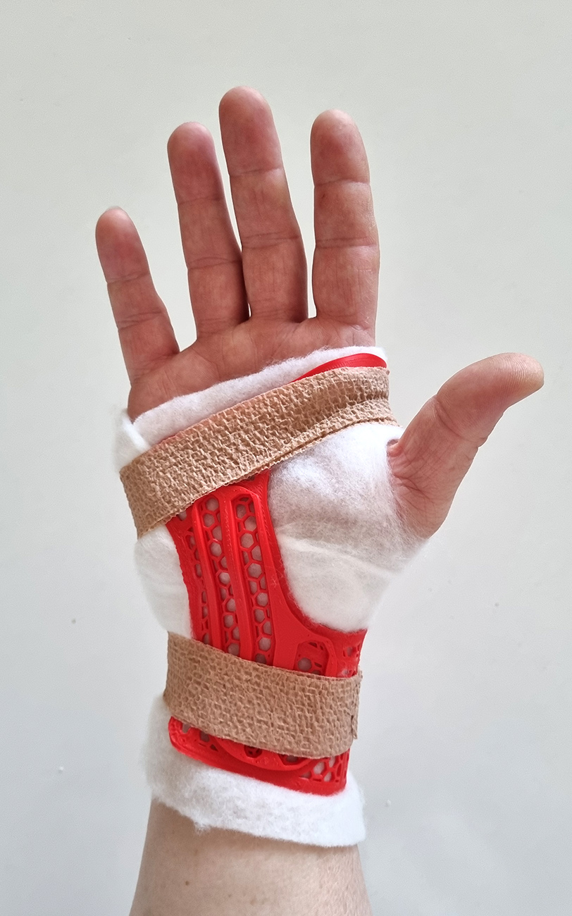 Wrist brace (splint) - a lighter version by Prusa Research | Download ...