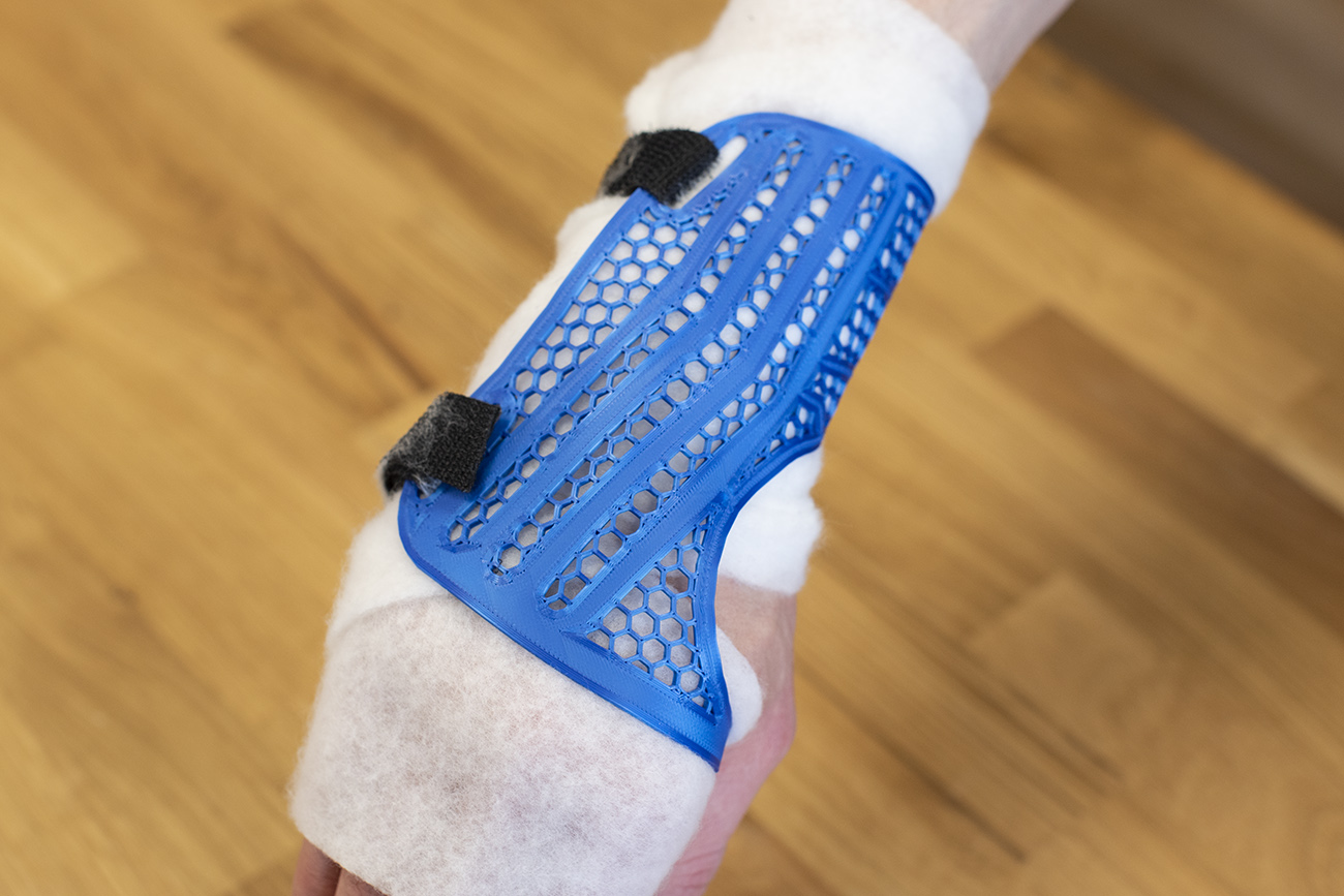 Wrist brace (splint) - a lighter version by Prusa Research | Download ...