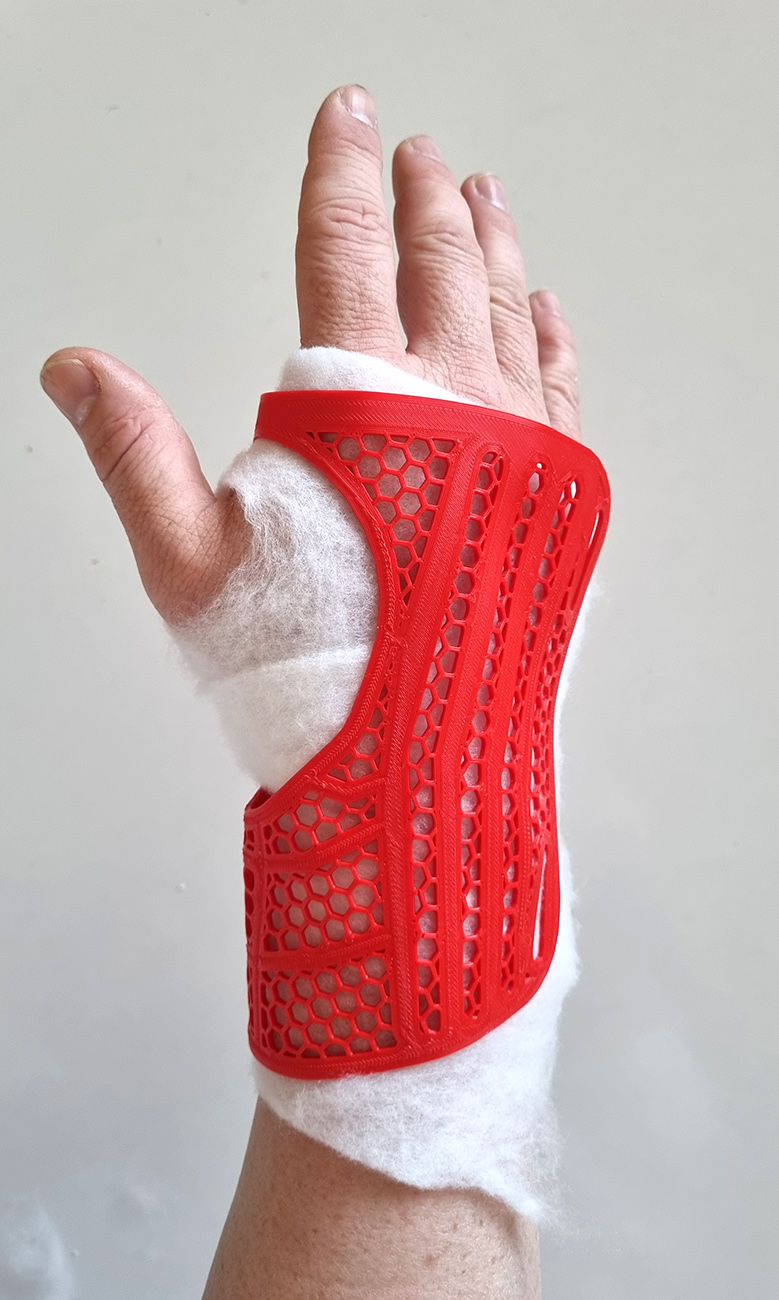 Wrist brace (splint) - a lighter version by Prusa Research | Download ...