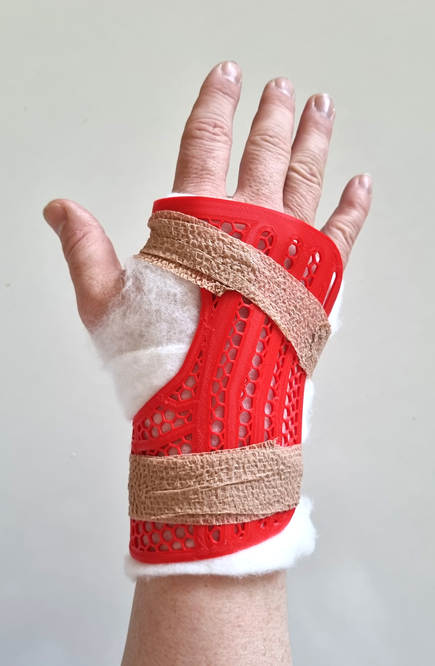 Wrist brace (splint) - a lighter version by Prusa Research | Download ...
