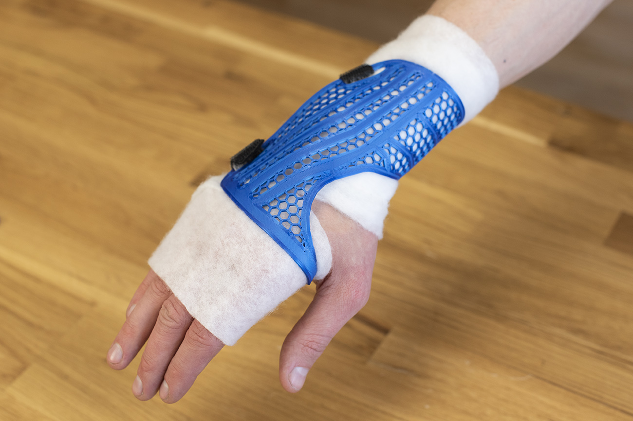 Wrist brace (splint) - a lighter version by Prusa Research | Download ...