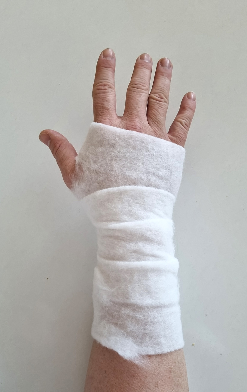 Wrist brace (splint) - a lighter version by Prusa Research | Download ...