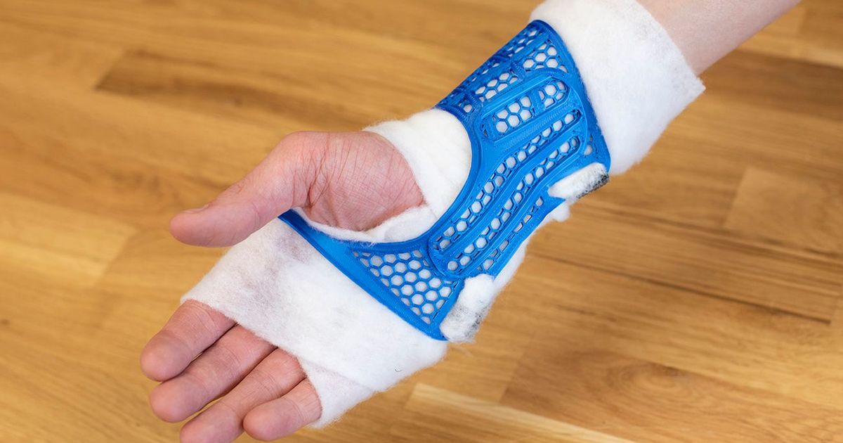 Wrist brace (splint) - a lighter version by Prusa Research | Download ...