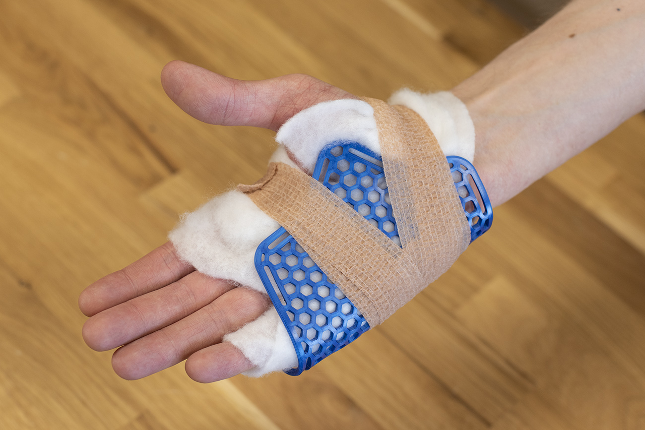Pinky finger/thumb brace (splint) by Prusa Research | Download free STL ...