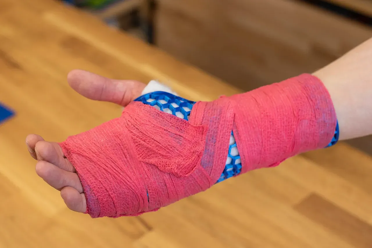 Palm brace (splint) by Prusa Research | Download free STL model ...