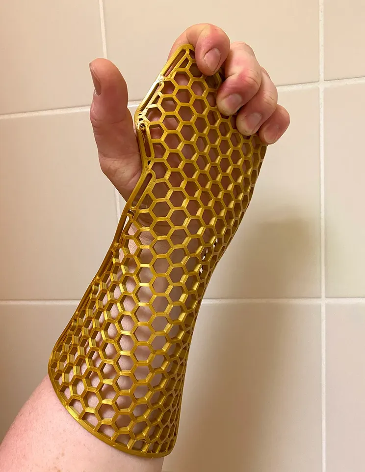 Palm brace (splint) by Prusa Research | Download free STL model ...