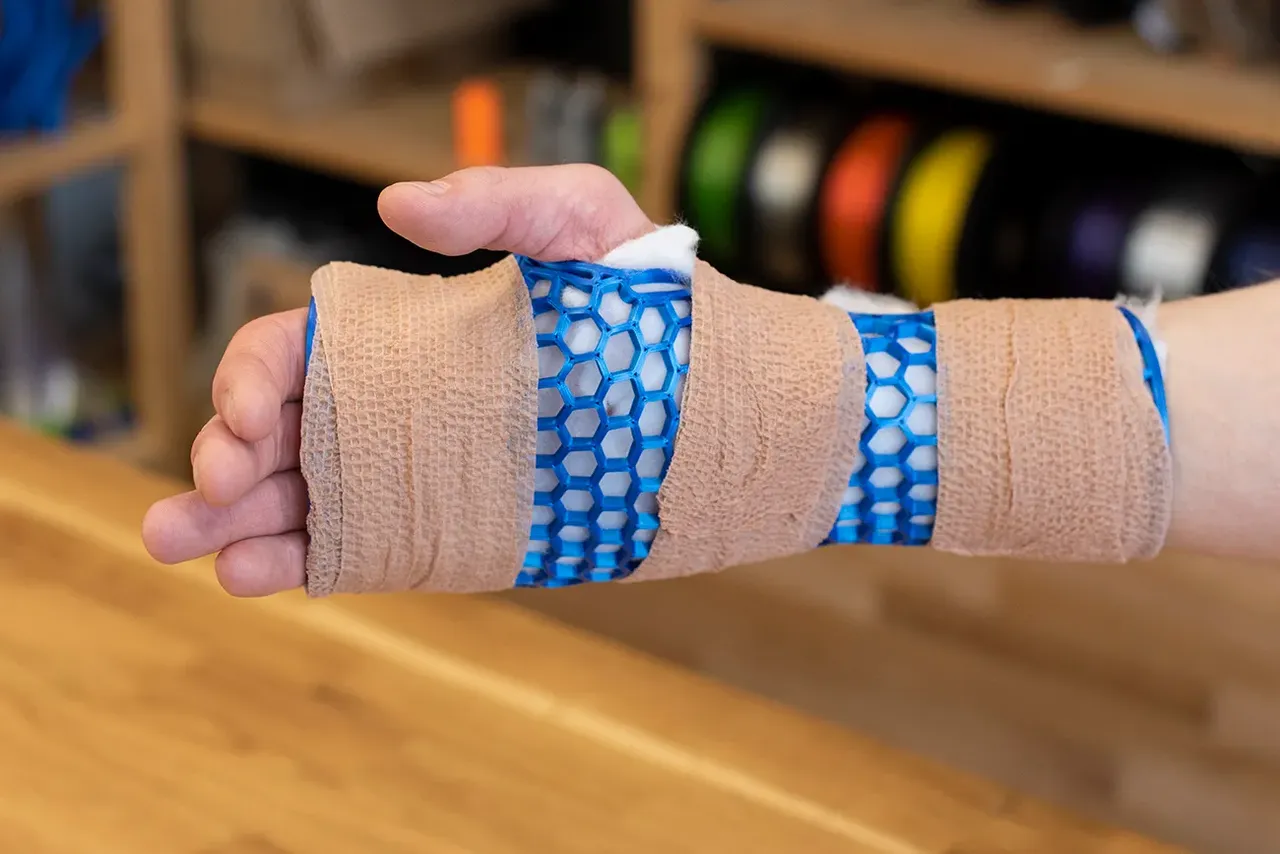 Palm brace (splint) by Prusa Research | Download free STL model ...