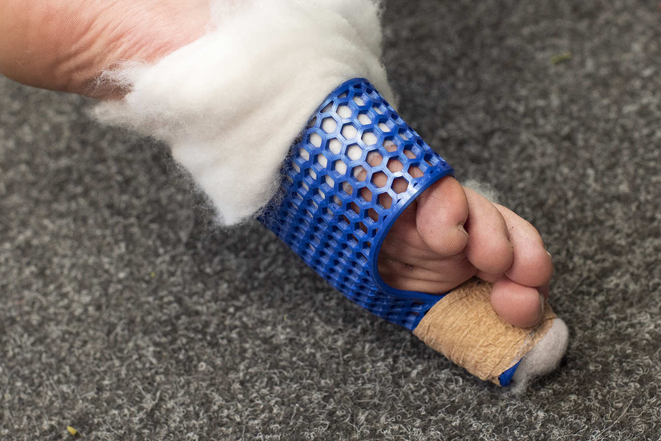 Big toe brace (splint) by Prusa Research | Download free STL model ...