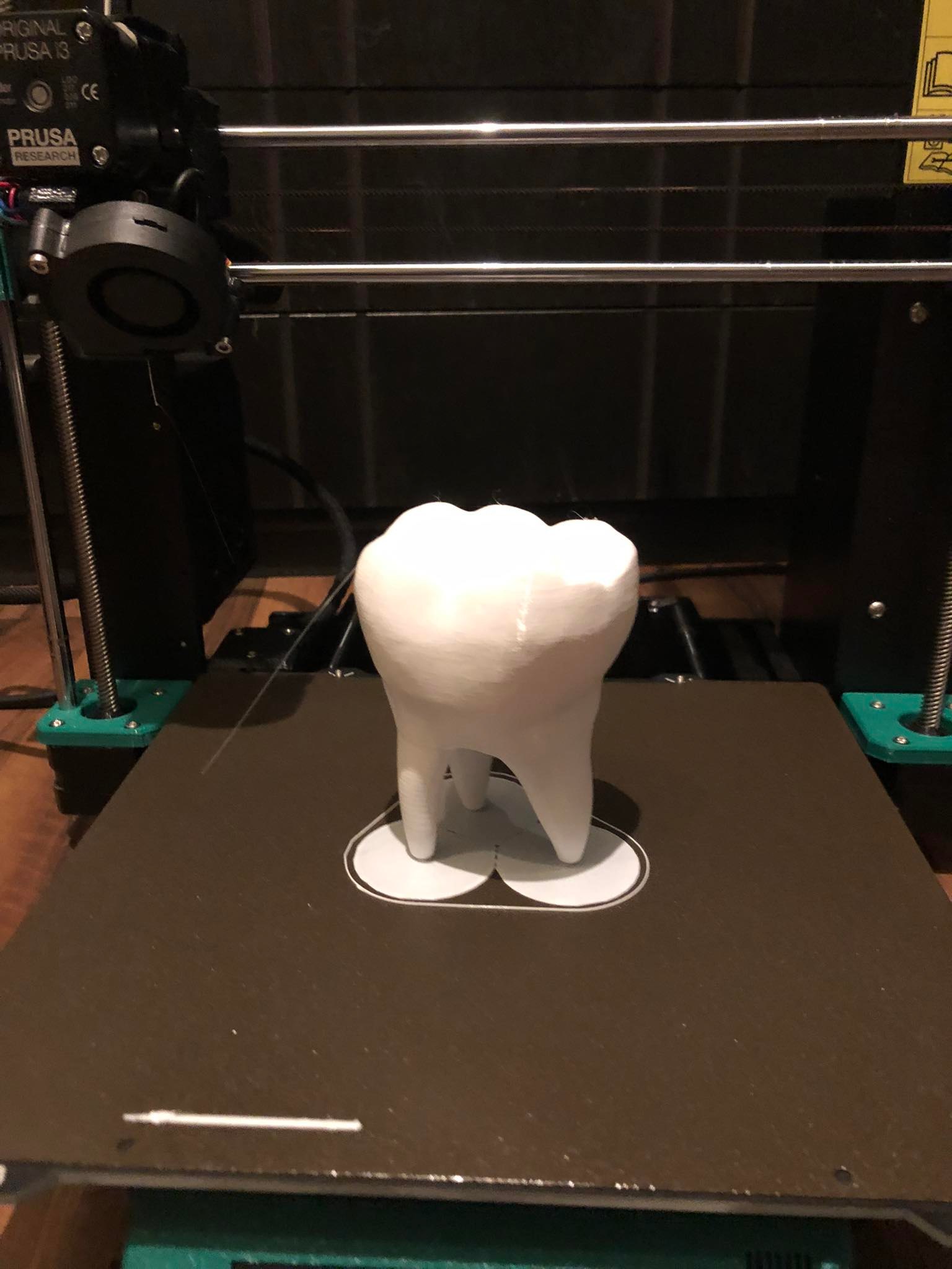 Tooth by Andrew | Download free STL model | Printables.com