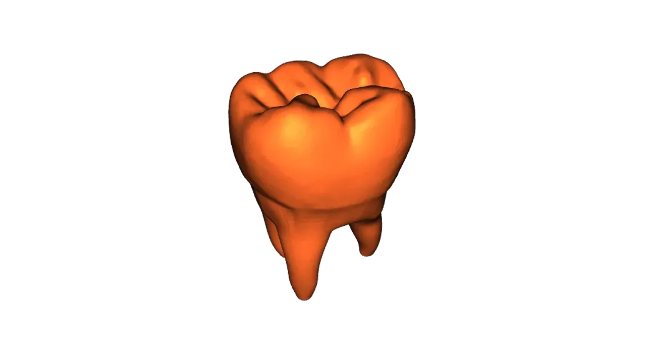 Tooth by Andrew | Download free STL model | Printables.com