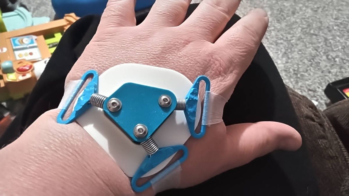 Carpal Tunnel Stretcher | Splint by Rat_Patrol | Download free STL ...