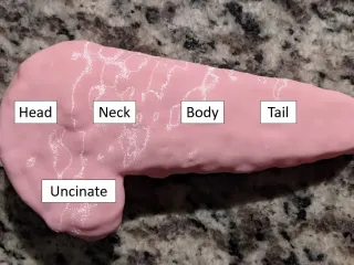 Pancreas v1 by bob_borygmos | Download free STL model | Printables.com