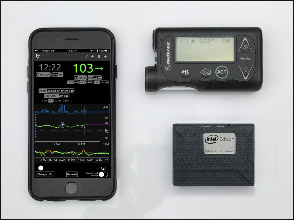OpenAPS Edison/Explorer Enclosure by rsilvers | Download free STL model ...