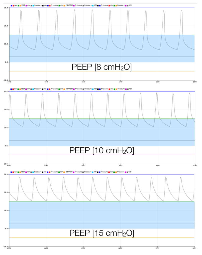 PANDApeep Gen2 PEEP valve by dtxtr | Download free STL model ...