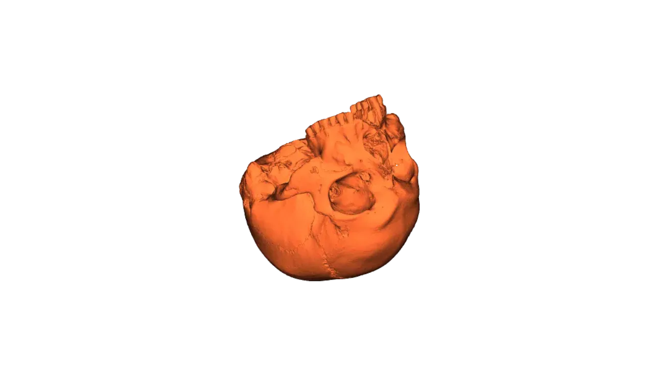 "Cranium with Injuries", a 661 year old skull, 3d scanned, and repaired ...