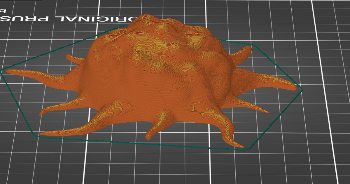 Cancer Tumor by Pinguinabatteri | Download free STL model | Printables.com