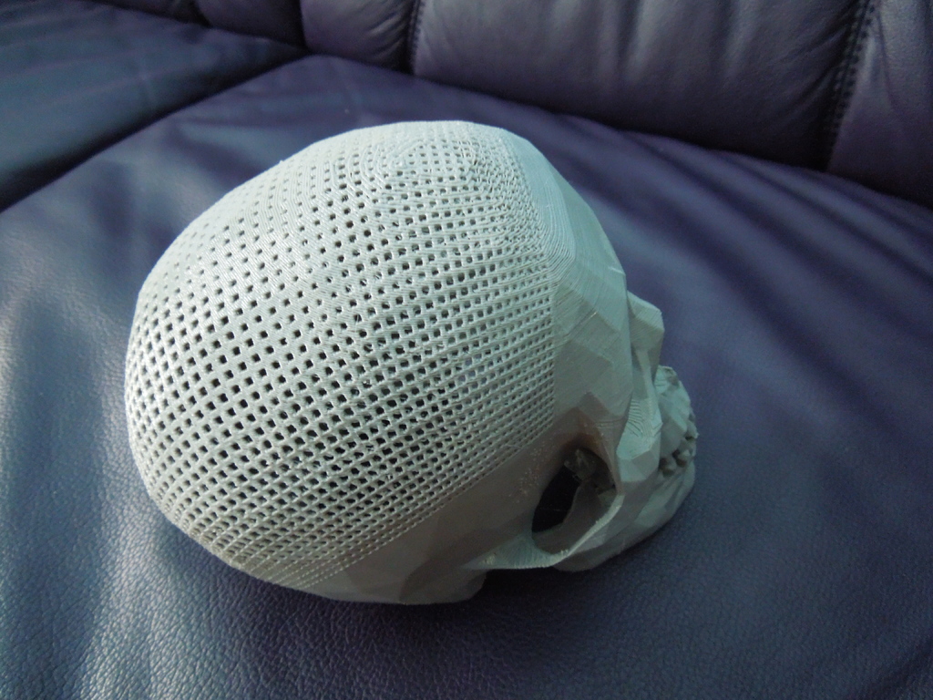 Customizable Stereographic Skull lowres by threonin | Download free STL ...