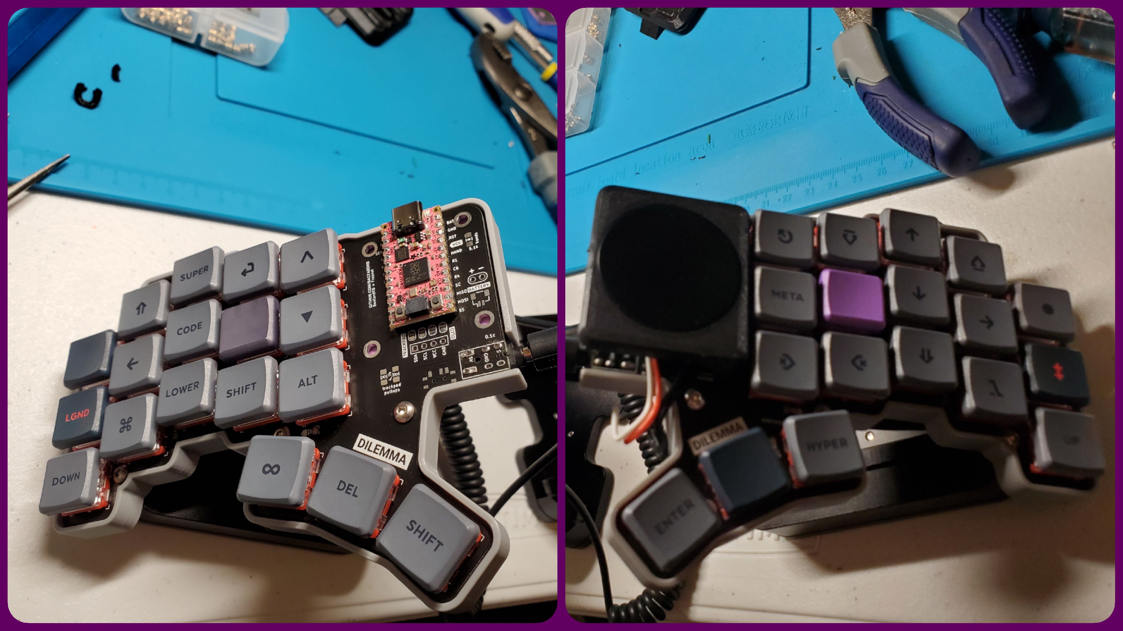 Dilemma Keyboard 3-Thumb Mod (Trilemma) Tripod-Mount Case by rmwphd ...