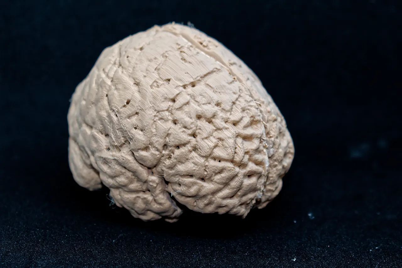 Human Brain Model from MRI Scan by KubiV | Download free STL model ...