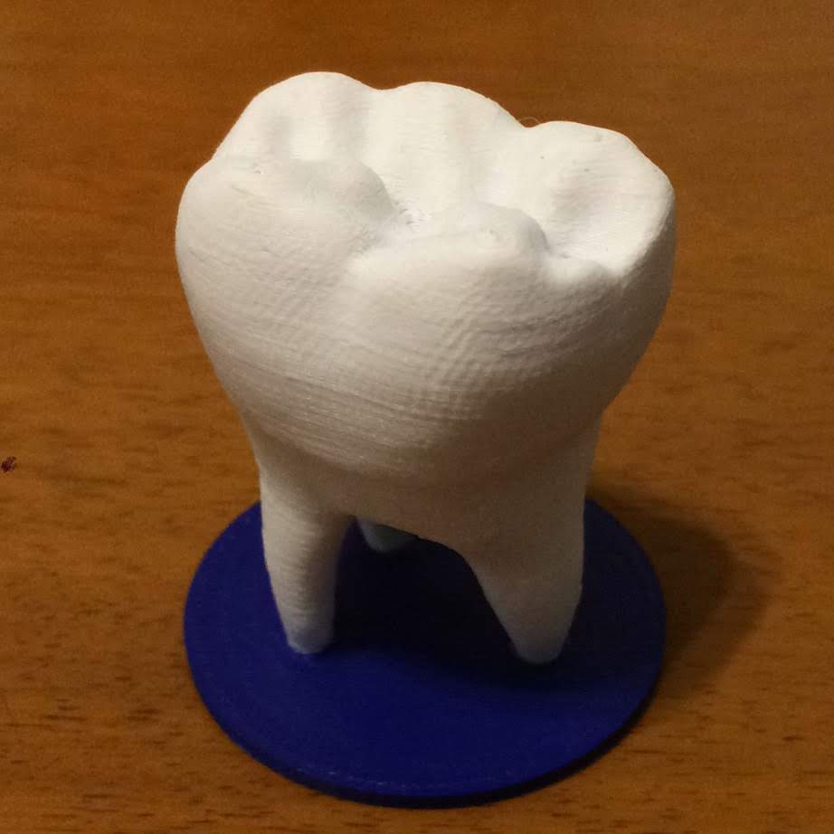 Odonto Tooth Decoration by Victor Maitan | Download free STL model ...