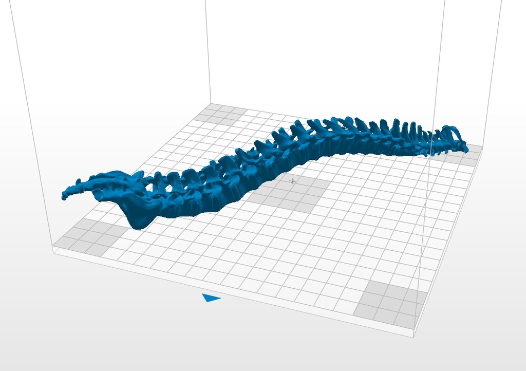 Human Spine with Exposure Stand by giufini | Download free STL model ...