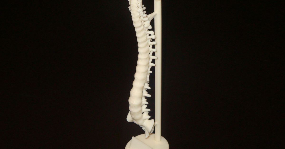 Human Spine with Exposure Stand por giufini | Descargar modelo STL ...