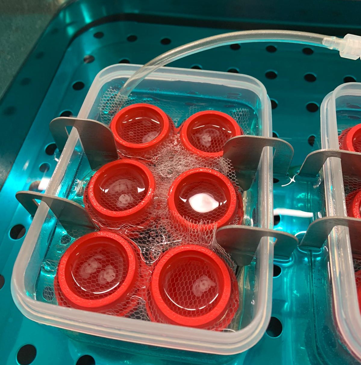 SMASH: Serial collection multi-well acute slice holder by Robert ...