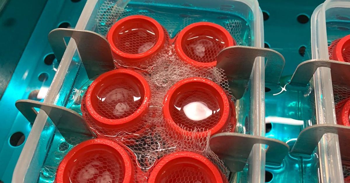 SMASH: Serial collection multi-well acute slice holder by Robert ...