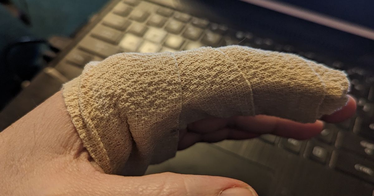 Simple Two-Finger Splint by ShopWizard | Download free STL model ...